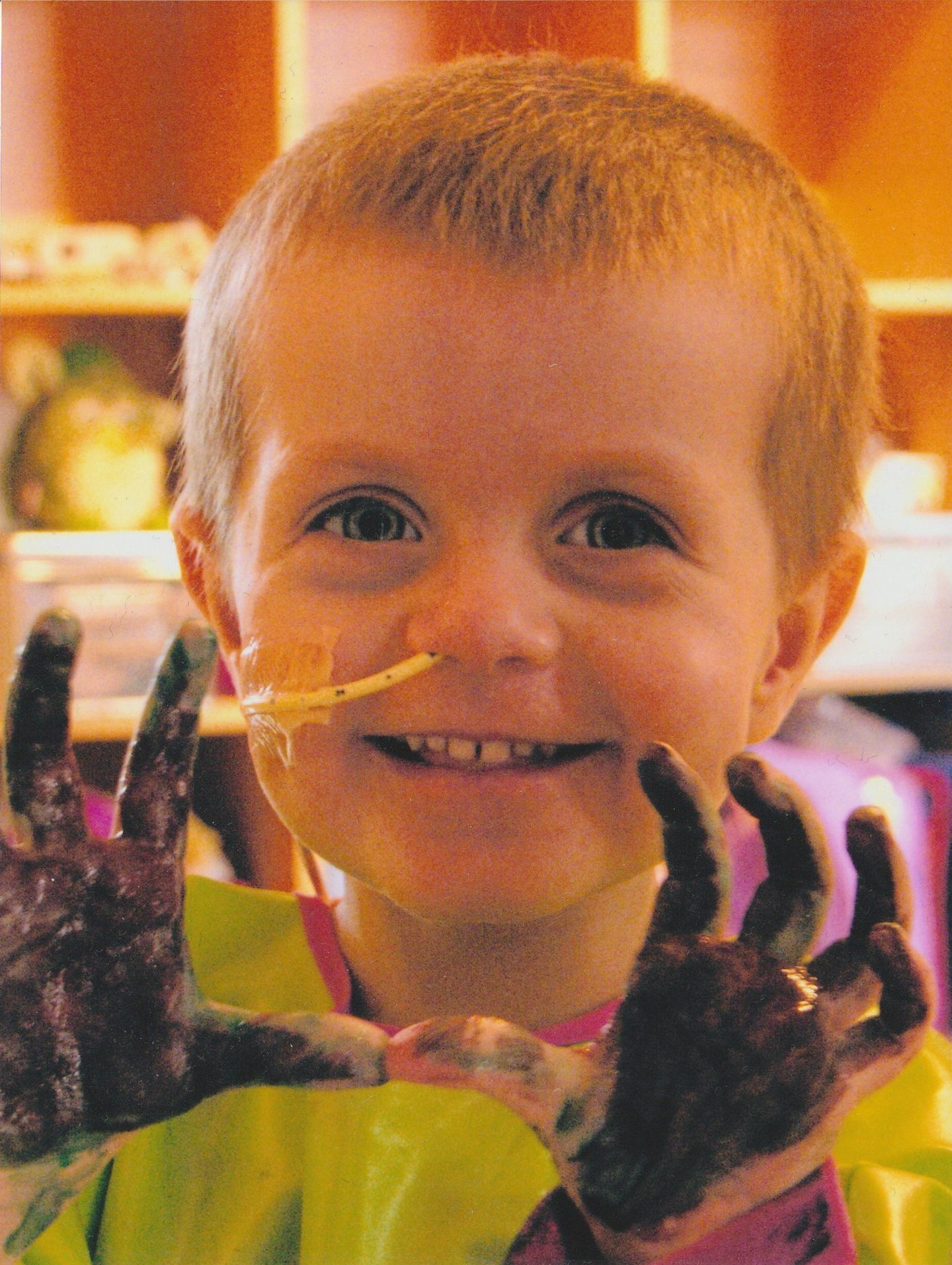 Molly | Solving Kids Cancer